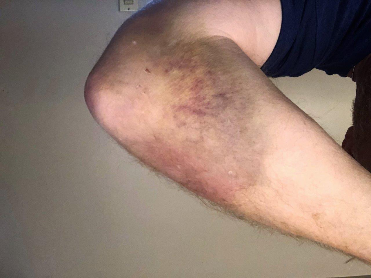 Schro Elbow | 1000fish's Blog - Steve Wozniak's hunt for fish species